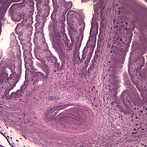 What is Cysticercosis? - Definition, Histopathology & Serology | Study.com