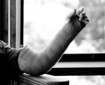 First Aid for Fractures | Study.com