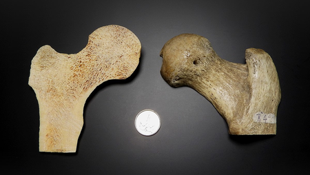 Anatomy of the Bone | Parts, Types & Categories - Lesson | Study.com