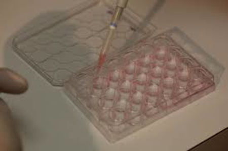 Molecular Testing & Diagnostics for Leukemia | Study.com