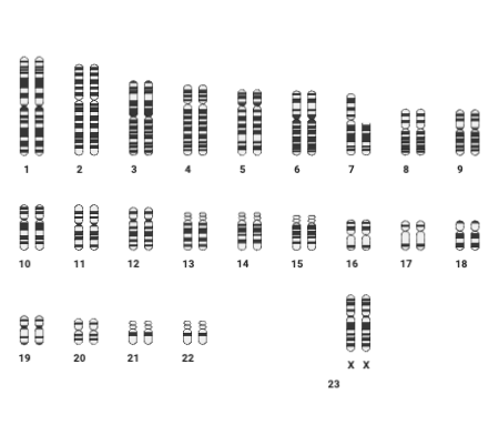 Analyzing a Karyotype to Identify Chromosomal Abnormalities Practice ...