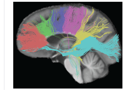 Arcuate Fasciculus | Structure, Location & Function - Lesson | Study.com