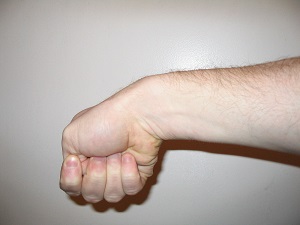 De Quervain's Tenosynovitis: Test, Splint & Treatment | Study.com