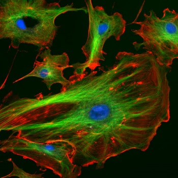 Cytoskeleton Lesson for Kids | Study.com