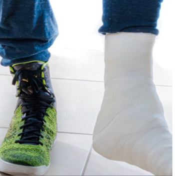 Splint vs. Cast | Overview, Differences & Uses - Lesson | Study.com