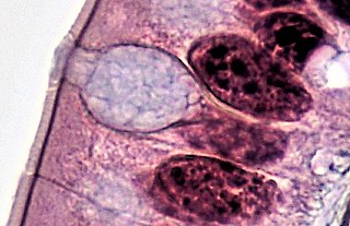 Ciliated Epithelium | Structure, Location & Function - Lesson | Study.com