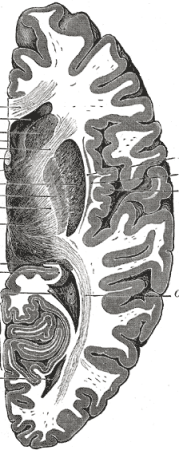 Sides of the Brain | Parts, Function & Diagrams - Lesson | Study.com