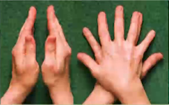 Chiral vs. Achiral: Definition & Examples - Lesson | Study.com