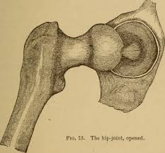 Partial Hip Dislocation: Definition & Causes | Study.com