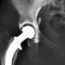 Polyethylene Structure & Uses - Lesson | Study.com