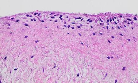 Joint Overview, Structure & Function - Lesson | Study.com