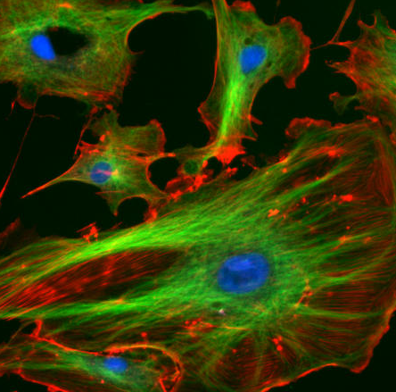 Immunocytochemistry vs. Immunohistochemistry | Overview & Uses - Lesson ...