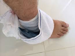 First Aid for Fractures | Study.com