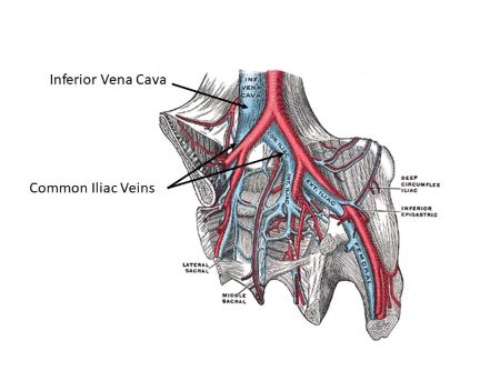The common iliac veins come together to form: (a) aorta (b) superior ...