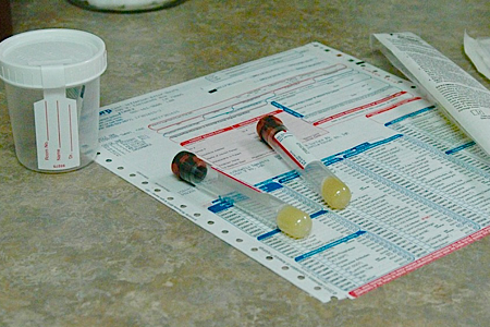 Diabetic Ketoacidosis | DKA Definition, Symptoms & Treatment | Study.com