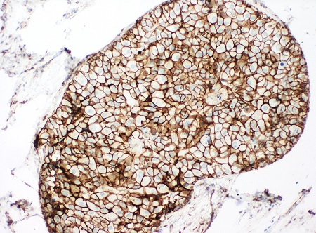 Immunohistochemistry Definition, Stains & Protocol | Study.com