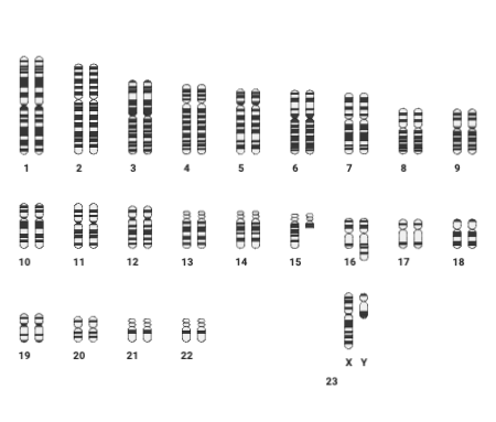 Analyzing a Karyotype to Identify Chromosomal Abnormalities Practice ...