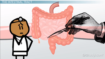 Intestinal Tract Treatment Vocabulary - Lesson | Study.com
