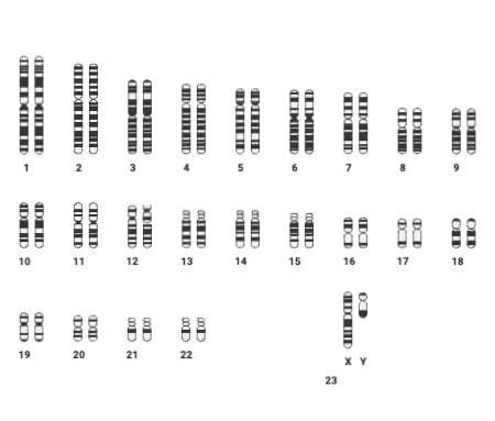 Analyzing a Karyotype to Identify Chromosomal Abnormalities Practice ...