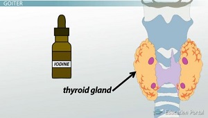 Thyroid Disorders: Hyperthyroidism, Hypothyroidism & Thyroidectomy ...