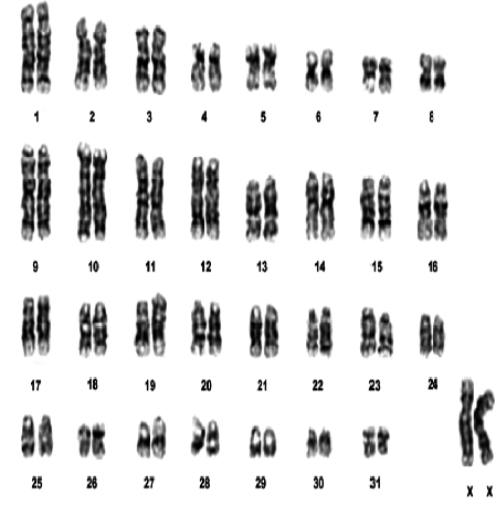 Analyzing a Karyotype to Identify Chromosomal Abnormalities Practice ...