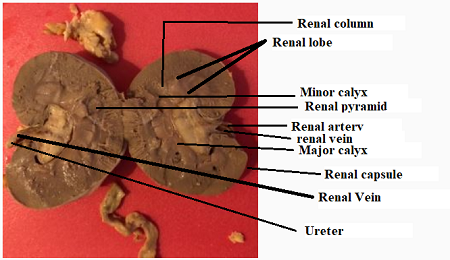 Label the major and minor calyx, the renal artery, renal capsule, renal ...