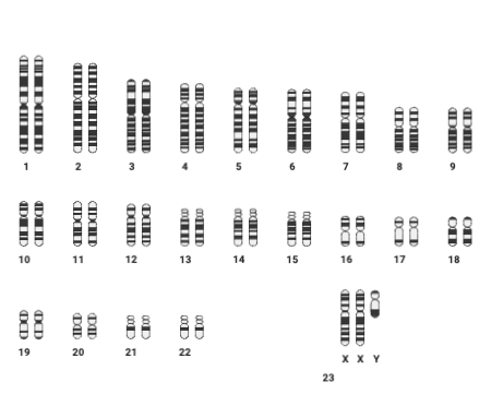 Analyzing a Karyotype to Identify Chromosomal Abnormalities Practice ...