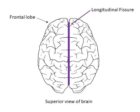 The right and left cerebral hemisphere are separated from each other by ...