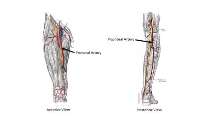 When the femoral artery passes behind the knee it becomes known as the ...