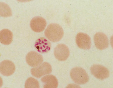 Malaria Parasites, Types & Life Cycle | Study.com