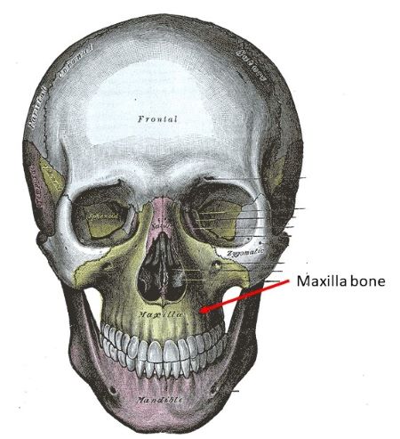 The upper teeth are anchored in the ______. a. nasal bones b. zygomatic ...