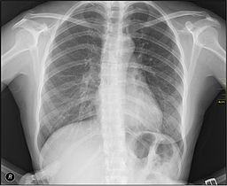 How Medical Imaging Uses Chemistry | Study.com