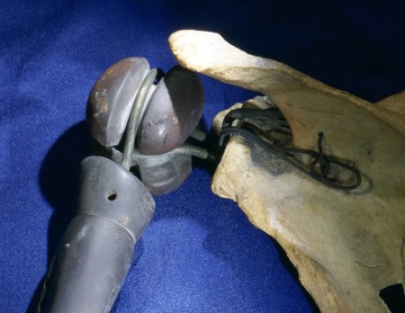 Ball & Socket Joint | Movement, Examples & Function - Lesson | Study.com