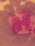 Monocytes | Definition & Function - Lesson | Study.com