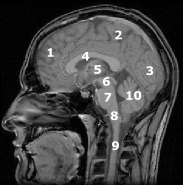 Gelastic Epilepsy & Seizures | Symptoms, Diagnosis & Treatment | Study.com