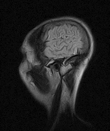 Radiology Medical Terminology | Overview & Examples - Lesson | Study.com