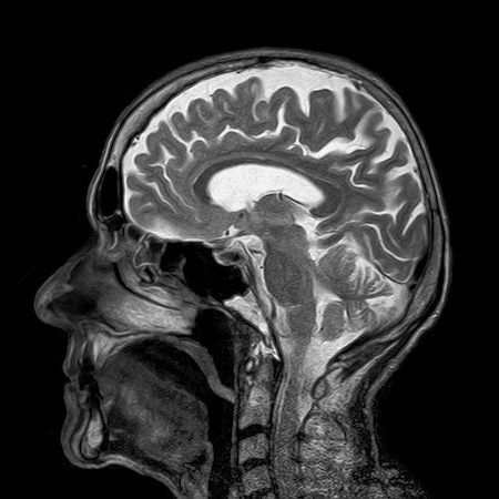 Biological Psychology | Definition & Topics - Lesson | Study.com