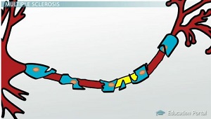 Myelin Sheath Definition, Overview & Functions - Lesson | Study.com