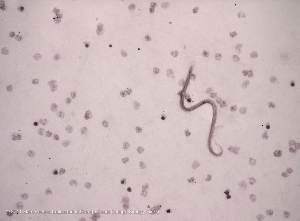 Nematode Symmetry & Movement | Study.com