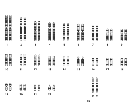 Analyzing a Karyotype to Identify Chromosomal Abnormalities Practice ...