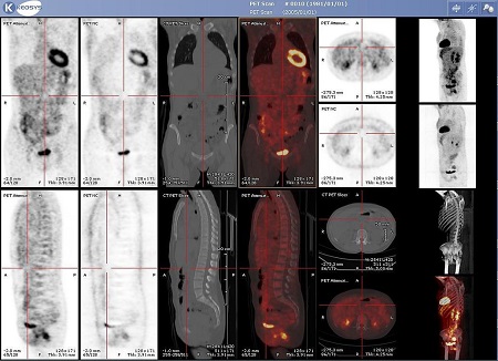 Physics in Medicine | Definition & Applications - Lesson | Study.com