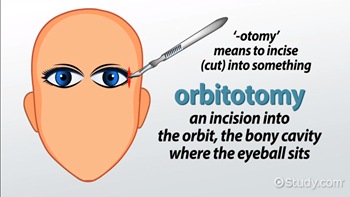 Eyeball, Eyelid & Orbit Procedure Vocabulary - Lesson | Study.com