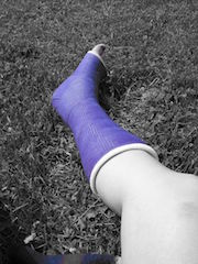 Gastrocnemius Recession: Procedure, Recovery & Complications | Study.com