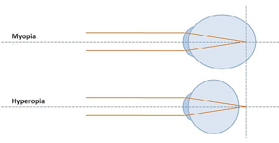 Eye Lens | Definition & Function - Lesson | Study.com