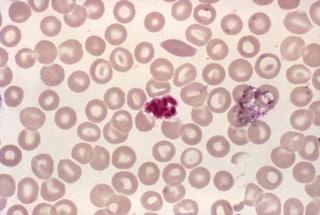 Blood Connective Tissue 400x