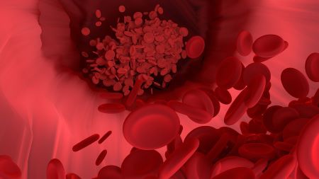 Metastasis in Cancer | Overview, Symptoms & Treatment - Lesson | Study.com