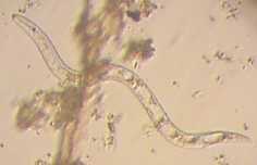 Infectious Agent | Definition, Types & Examples - Lesson | Study.com