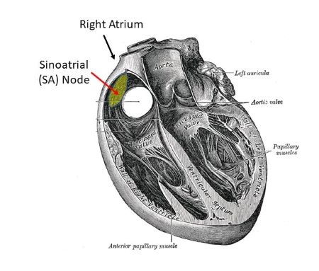 The "pacemaker" of the heart is the A. SA node. B. AV node. C. AV ...