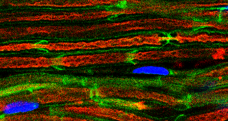 Schwann Cells Function, Histology & Functions | Study.com