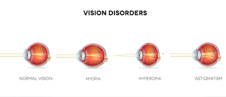 The Eye: Structure, Image Detection & Disorders | Study.com